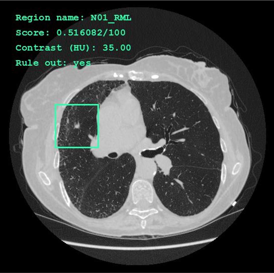 Research – Oxford Radiology Research Unit